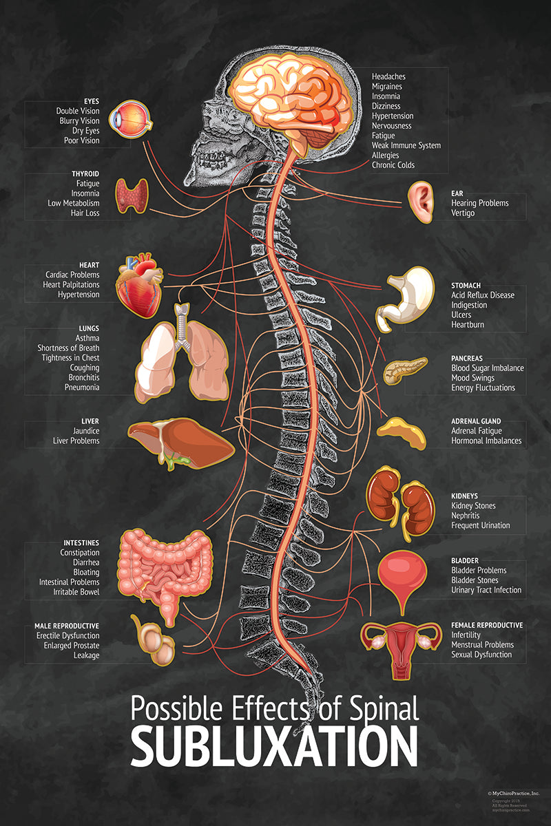 Chiropractic Posters And Charts
