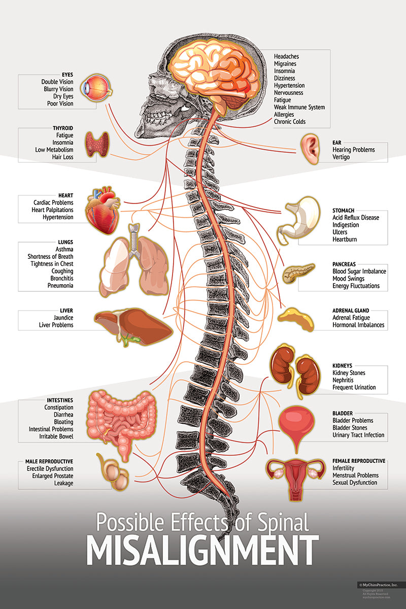 Chiropractic Spinal "Misalignment" Nerve and Symptom Chart ...