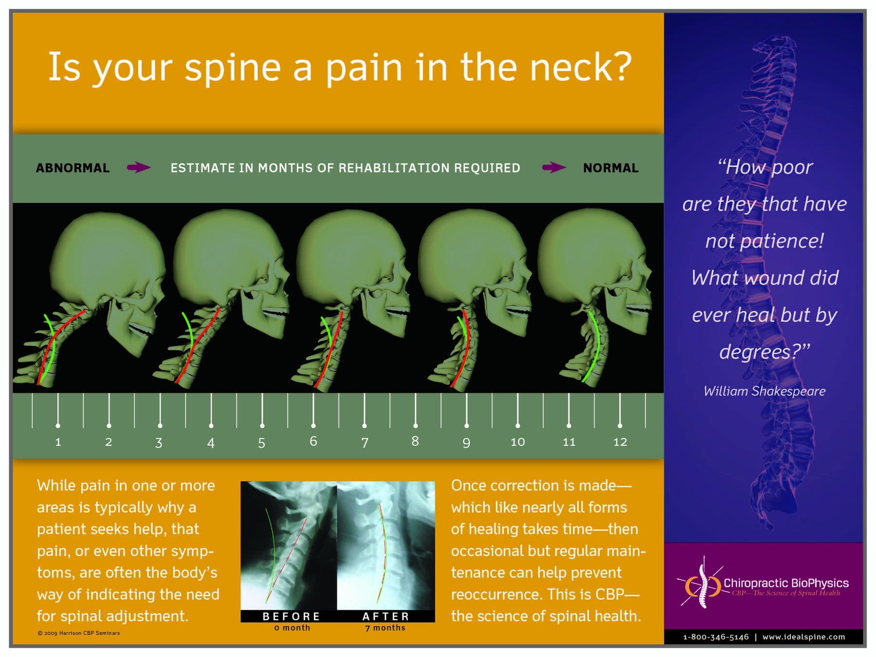 Cervical Estimate of Rehabilitation – Chiropractic BioPhysics